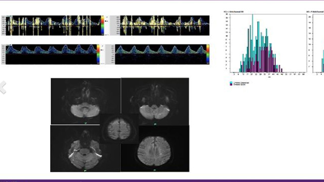 EuroPCR 2023 Hotlines / Late-Breaking Trials: TAVI