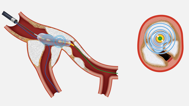 How CTO techniques can help you in your everyday practice?
