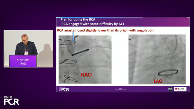 MINOCA to STEMI, a wild world