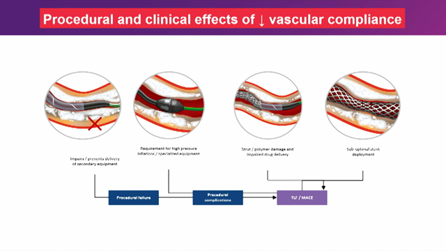 OCT-guided PCI for a patient with calcified lesion