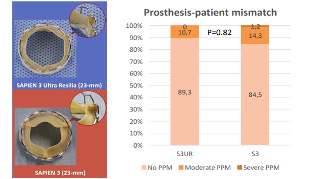 TAVI - New indications, techniques and devices - Part 1