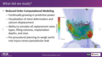 TAVI (Transcatheter aortic valve implantation)