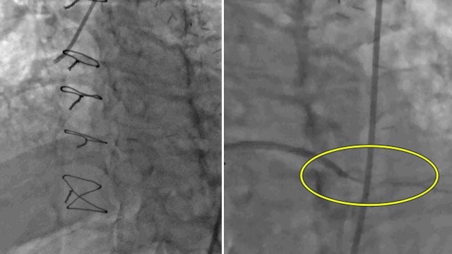 Agent of change: modern PCI with DCB