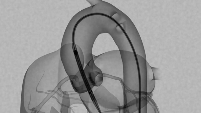 Think SMART! Valve precision and performance matters