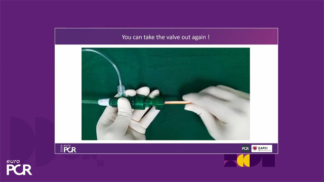 Align for the future with next-generation balloon expandable THV technology