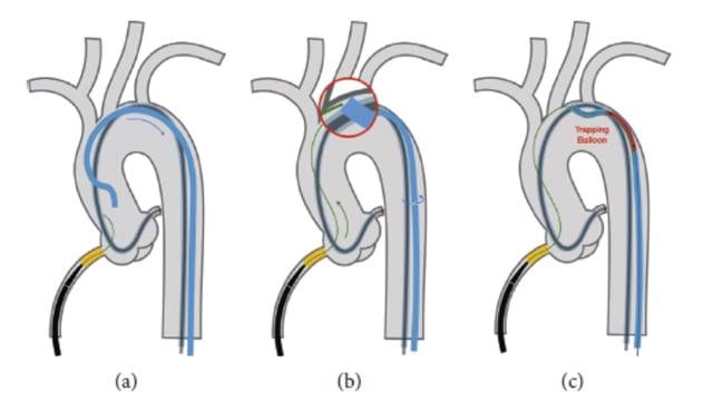 CTO PCI: from planning to execution