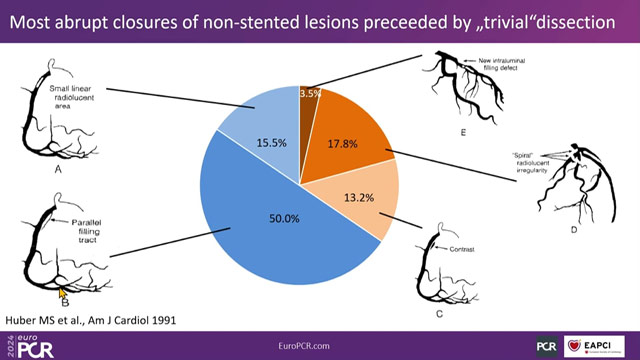 DCB PCI for de novo lesions: when and how?