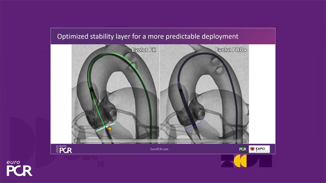 Expanding the heart team - Improved TAVI outcomes through pre-and post ...