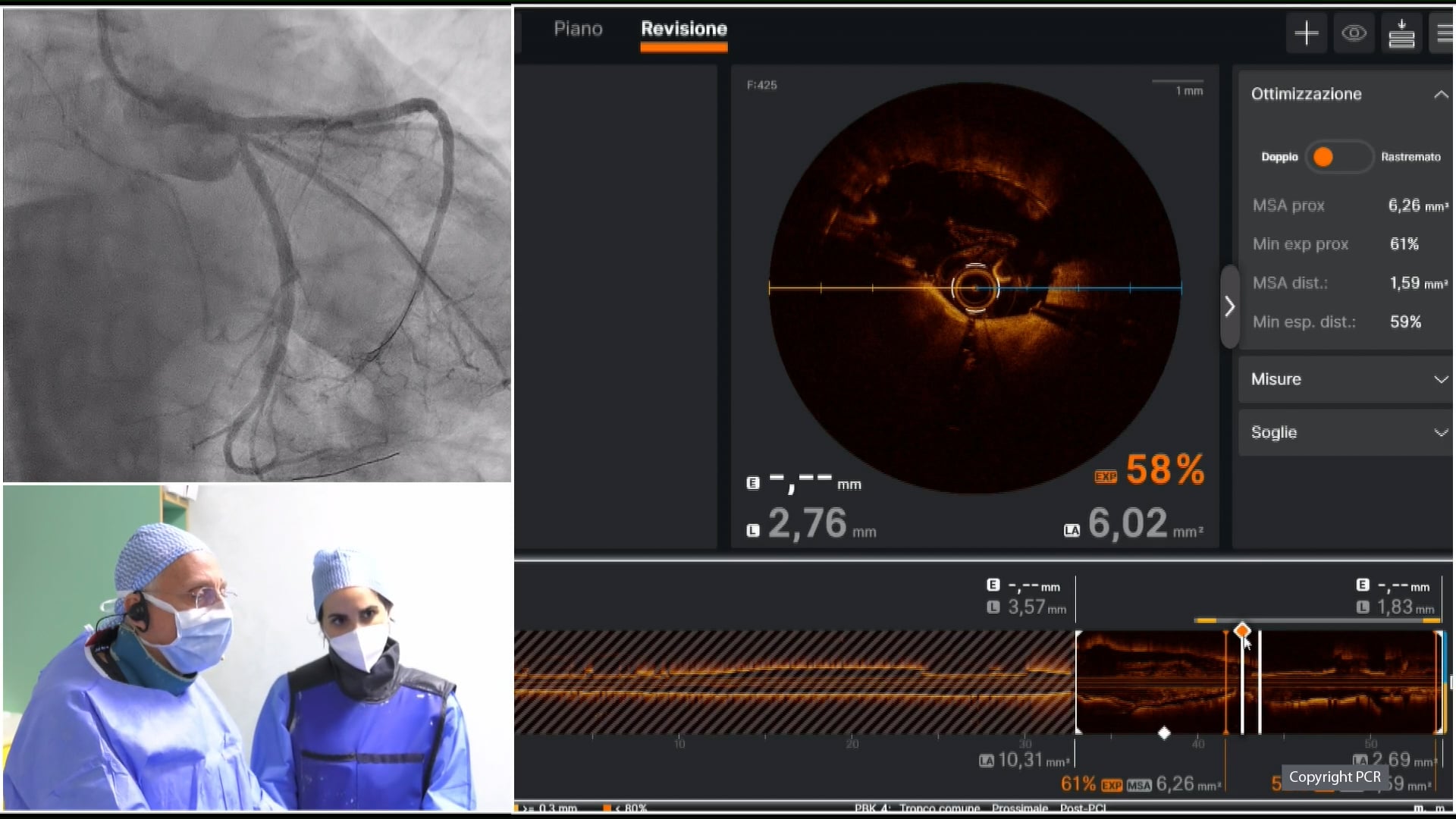 Imaging-guided left main PCI - LIVE case