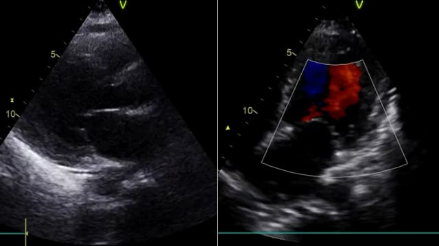 Left main: presentation and diagnosis