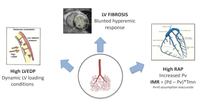 Management of patient with coronary artery disease and left ventricle ...