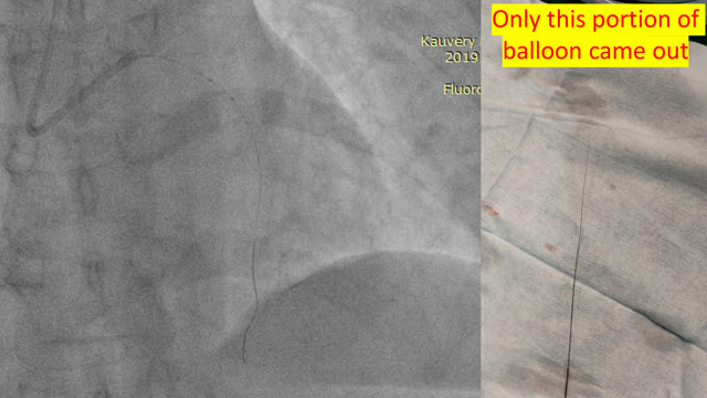Management of PCI complications - Part 2