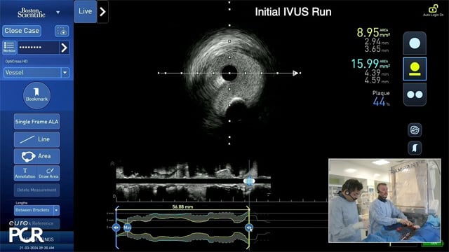 A new horizon in IVUS-guided PCI of calcified stenoses with artificial ...