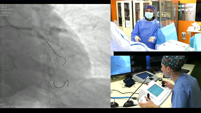 Robotic PCI: tips and tricks, challenging anatomies and future perspectives