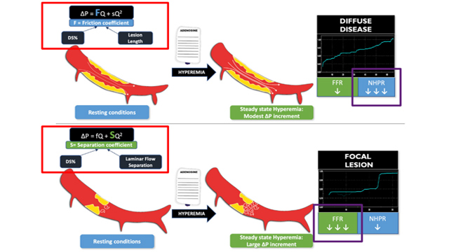 Role of PCI in the contemporary management of patients with angina and ...