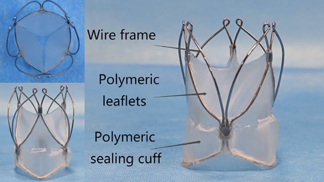 TAVI: new devices, original solutions for procedural complications