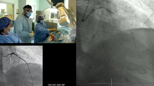 Ultra-low contrast techniques to improve the safety and quality of PCI ...