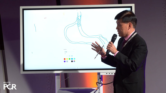When and how to treat the side branch in non-left main bifurcations?