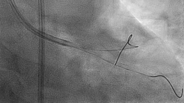 How to deal with PCI complications