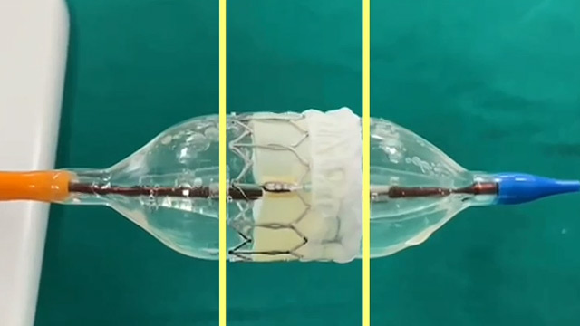Rendez-vous with Myval THV series and Landmark RCT subset analysis