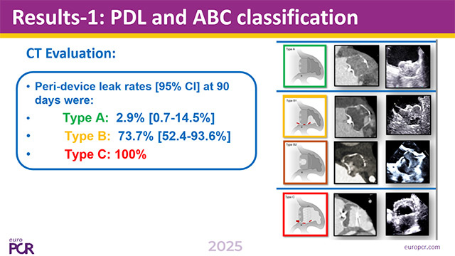 A central role for cardiac imaging in transcatheter LAA closure