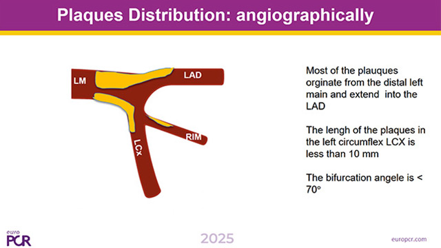 Bifurcation CAD: presentation and PCI strategies