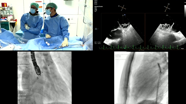 Broadening OPTIONs for LAA closure: innovations and outcomes