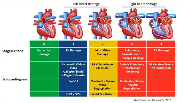 Hotline TAVI 1: extended analysis of the randomised trials