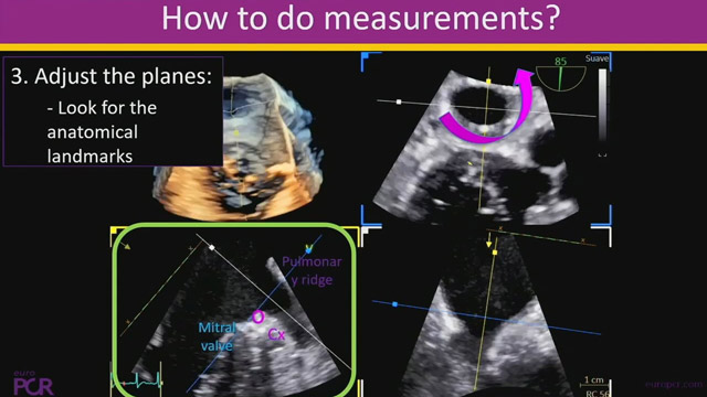 Optimal use of cardiac imaging to plan and guide transcatheter LAA closure