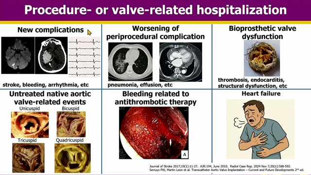 The Landmark RCT - One-year results