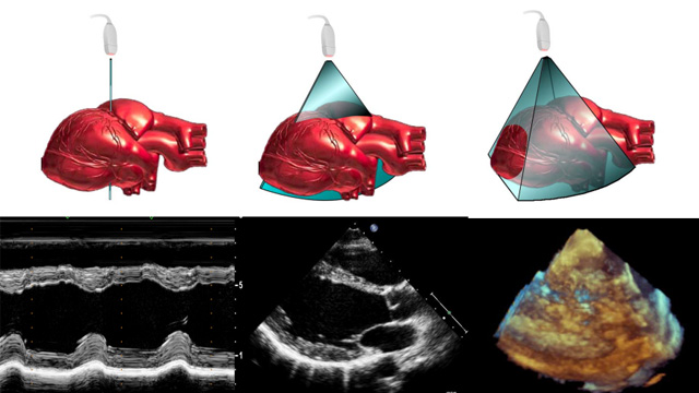 3D echocardiography for structural procedures