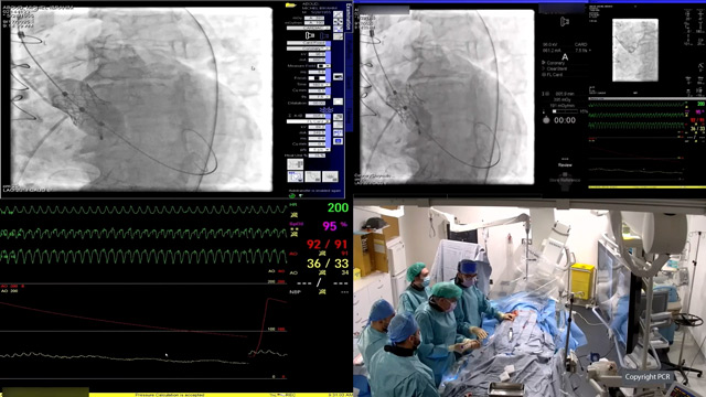 Myval transcatheter heart valve series - Align for the future with ...