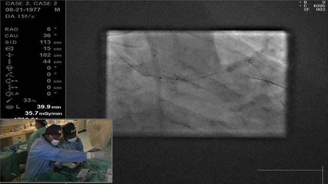 Calcified left main distal trifurcation PCI - LIVE Case