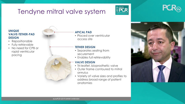 Tendyne transcatheter mitral valve implantation