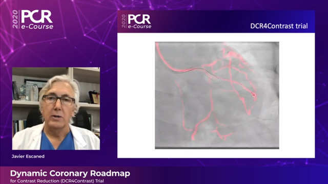 Dynamic coronary roadmap for contrast reduction (DCR4Contrast) trial
