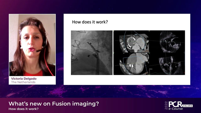 What's new on fusion imaging