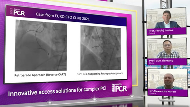 Innovative access solutions for complex PCI