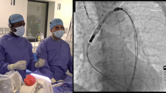 TAVI (Transcatheter aortic valve implantation)
