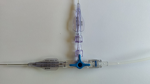 How to perform simultaneous kissing balloon inflation with a single ...