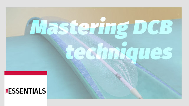 Effective techniques for performing DCB angioplasty