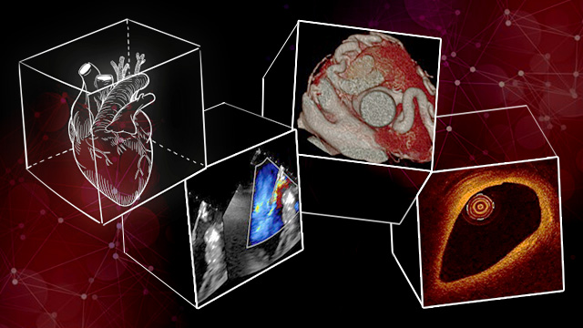 The unimaginable evolution of interventional cardiology from ...