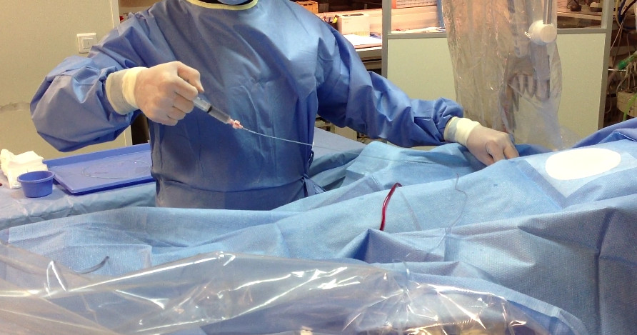 Catheter exchange with syringe technique