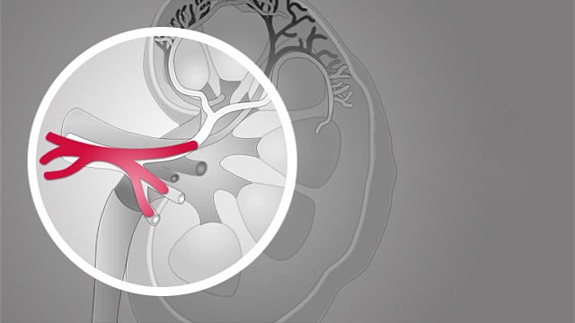 The 2023 ESH Hypertension Guidelines revisit the role of renal denervation