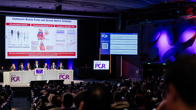 Spotlight on major Late-Breaking Trials presented at EuroPCR 2025