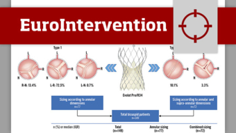 TAVI (Transcatheter aortic valve implantation)
