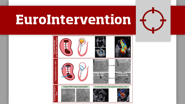 Electrosurgical laceration and stabilisation of three clip devices ...