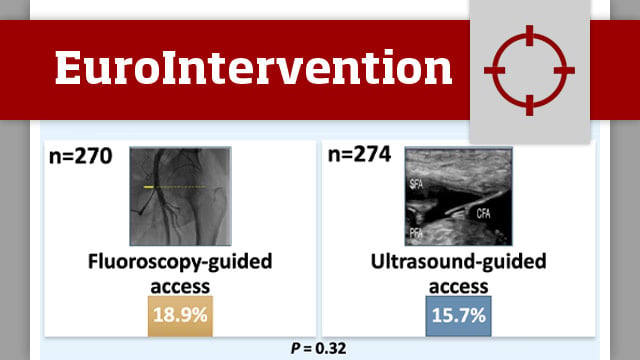 Ultrasound-guided versus fluoroscopy-guided large-bore femoral access ...