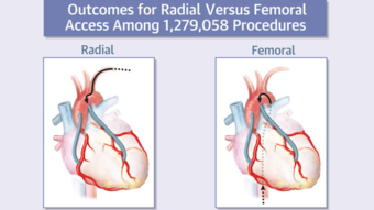 Radial approach