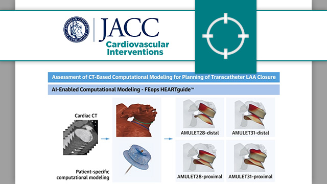 Coronary obstruction from TAVR in native aortic stenosis : development ...