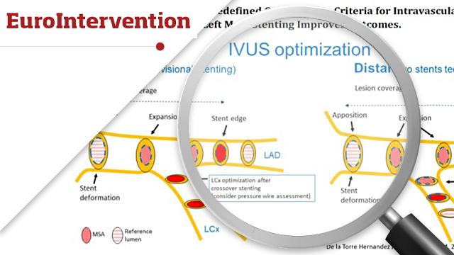 The application of predefined optimisation criteria for intravascular ...